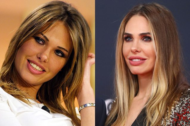 Prima e dopo la chirurgia: il ritocchino alle labbra