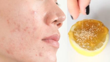 How to Remove Dark Spots on Your Face with Lemon Juice | Cookist.com