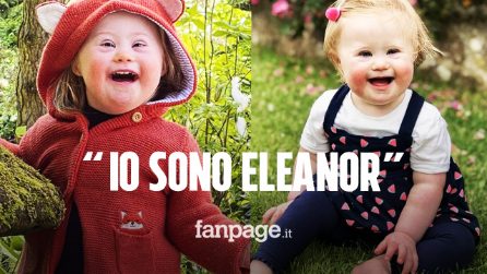 Lily, la bimba con la sindrome di Down diventa modella e cambia il ...